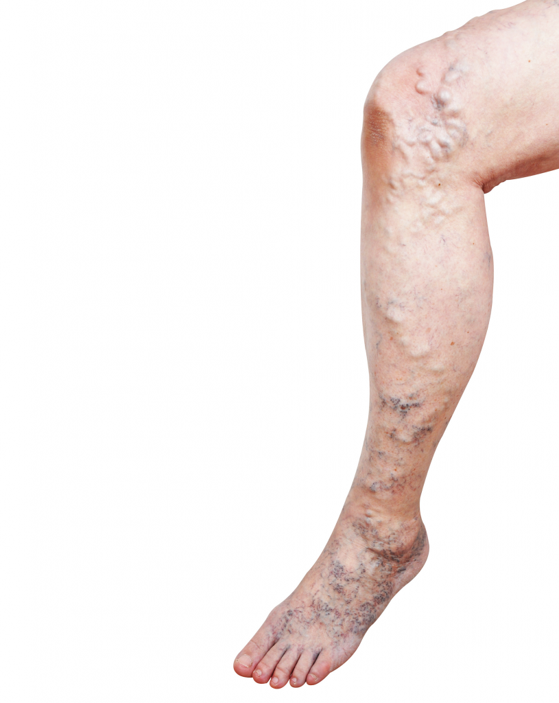 The Complete Guide to Chinese Medicine Bloodletting — by Dean Mouscher